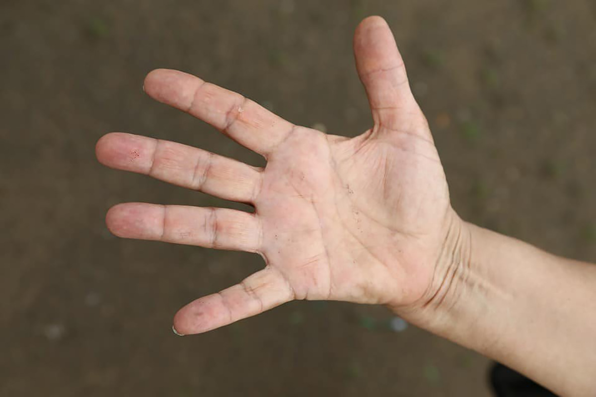 Comment soulager les rhumatismes naturellement